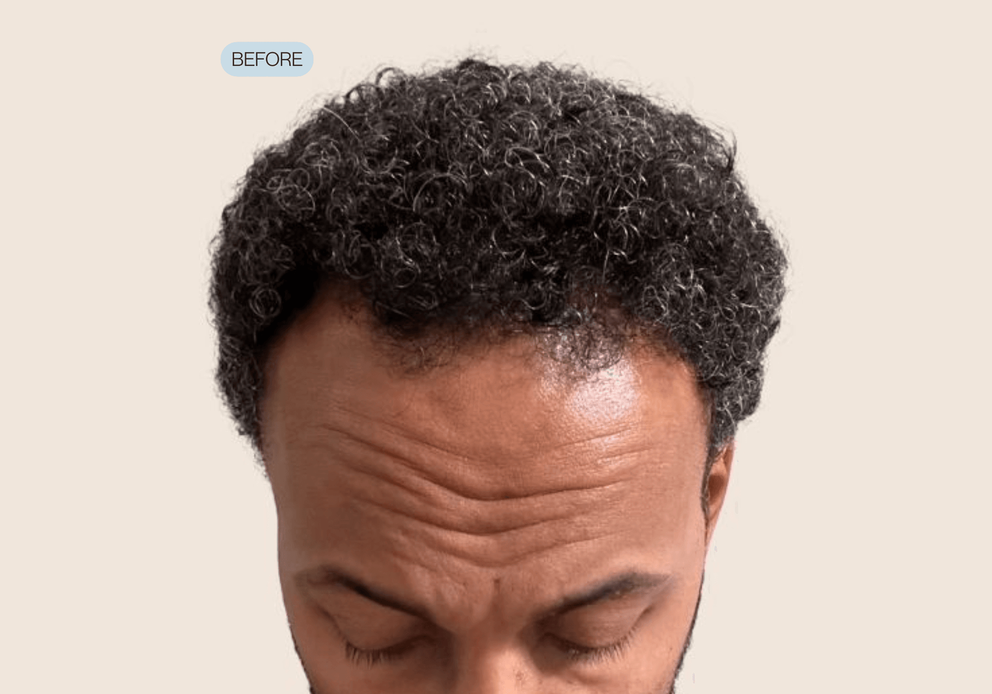 The Destination for Scalp & Hair Health – NatureLab. TOKYO